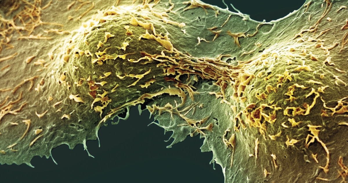 Bleomycin-Induced Lung Injury